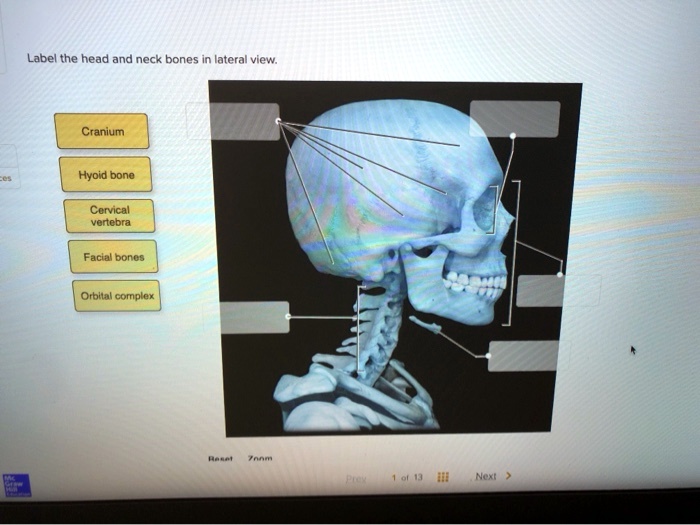Label the head and neck bones in lateral view. Cranium Hyoid bone ...