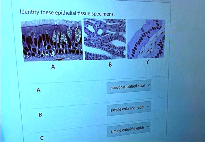 SOLVED: Identify these epithelial tissue specimens A A pseudostratified ...