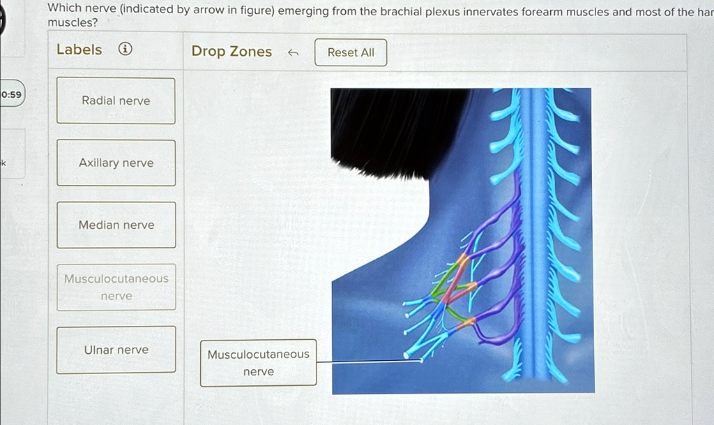 Which nerve (indicated by arrow in figure) emerging from the brachial ...