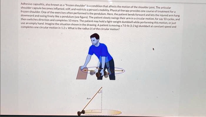 Adhesive capsulitis, also known as a "frozen shoulder" is a condition ...