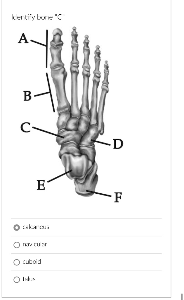 [GET ANSWER] identify bone c calcaneus navicular cuboid talus identify ...