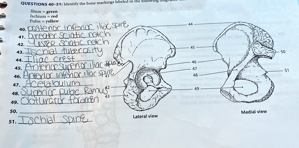 QUESTIONS 40-51: Identify the bone markings labeled in the following ...