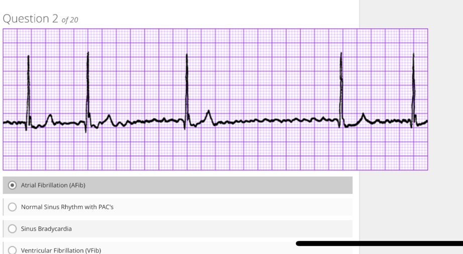 question 2 of 20 atrial fibrillation afib normal sinus rhythm with pacs ...