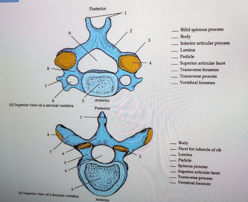 SOLVED: Can't read handwriting. Posterior Bifid spinous process Body ...
