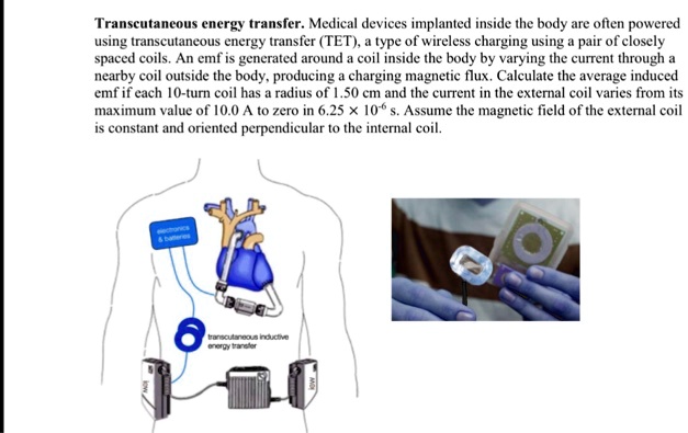 SOLVED: Transcutancous energy transfer Medical devices implanted inside ...