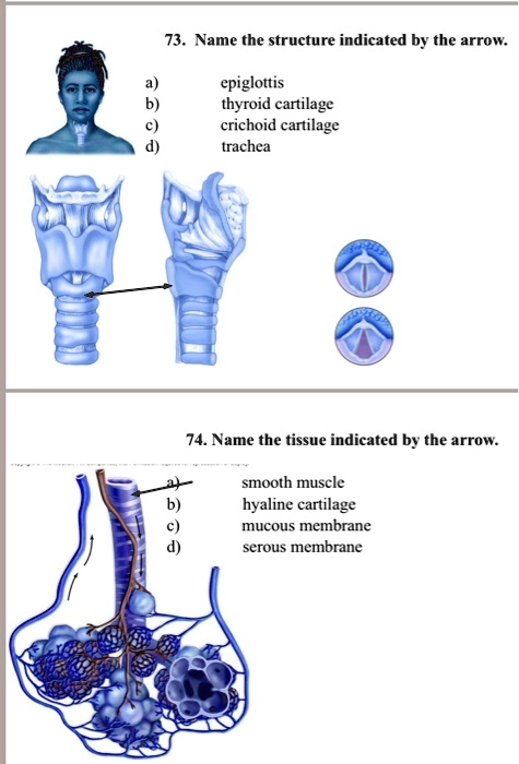 SOLVED: 73 Name the structure indicated by the arrow: epiglottis thyroid cartilage crichoid ...