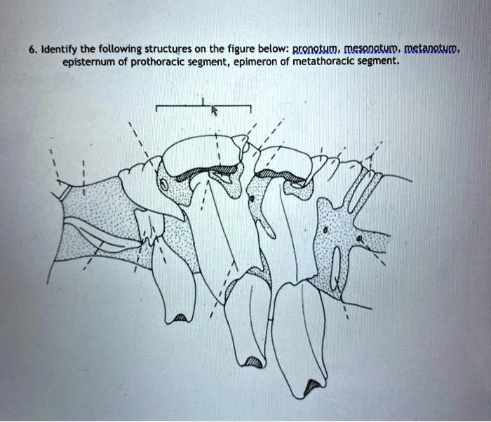 SOLVED:Identify the following structures on the figure below: Rronotym ...