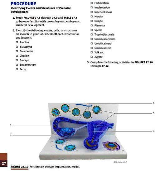 SOLVED: PROCEDURE: Identifying Events and Structures of Prenatal ...