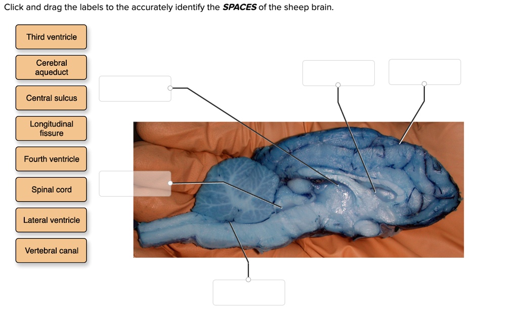 Click and drag the labels to the accurately identify the SPACES of the ...