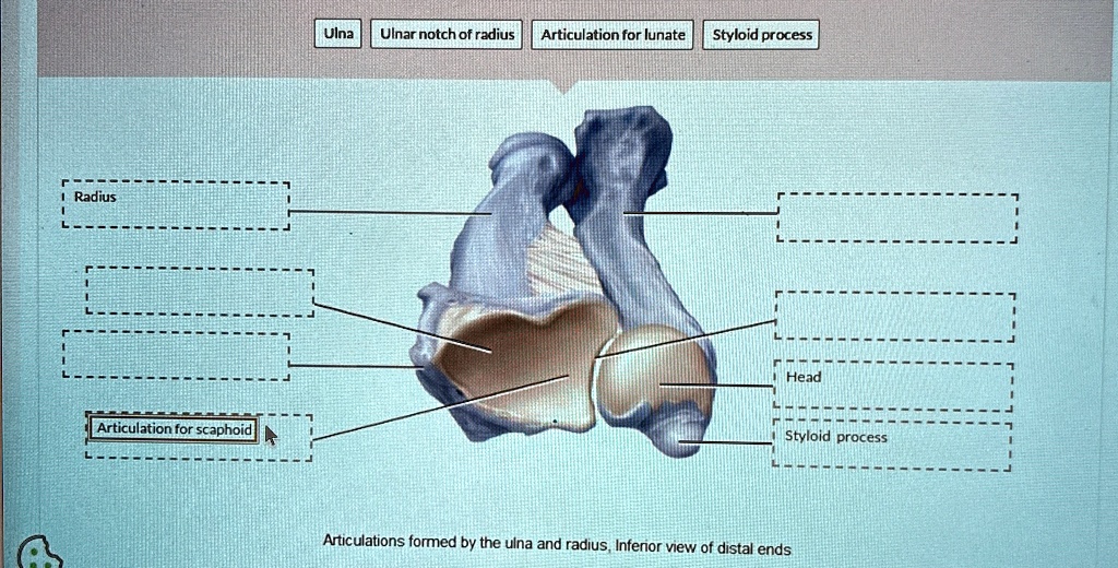 Radius Articulation for scaphoid Ulna Ulnar notch of radius ...