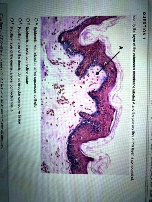 QUESTION 1 Identify the layer of the cutaneous membrane labeled A and ...