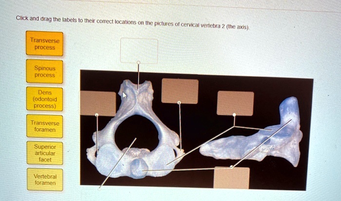 click and drag the labels to their correct locations on the pictures of ...