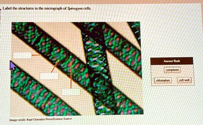Label the structures in the micrograph of Spirogyra cells. Image credit ...