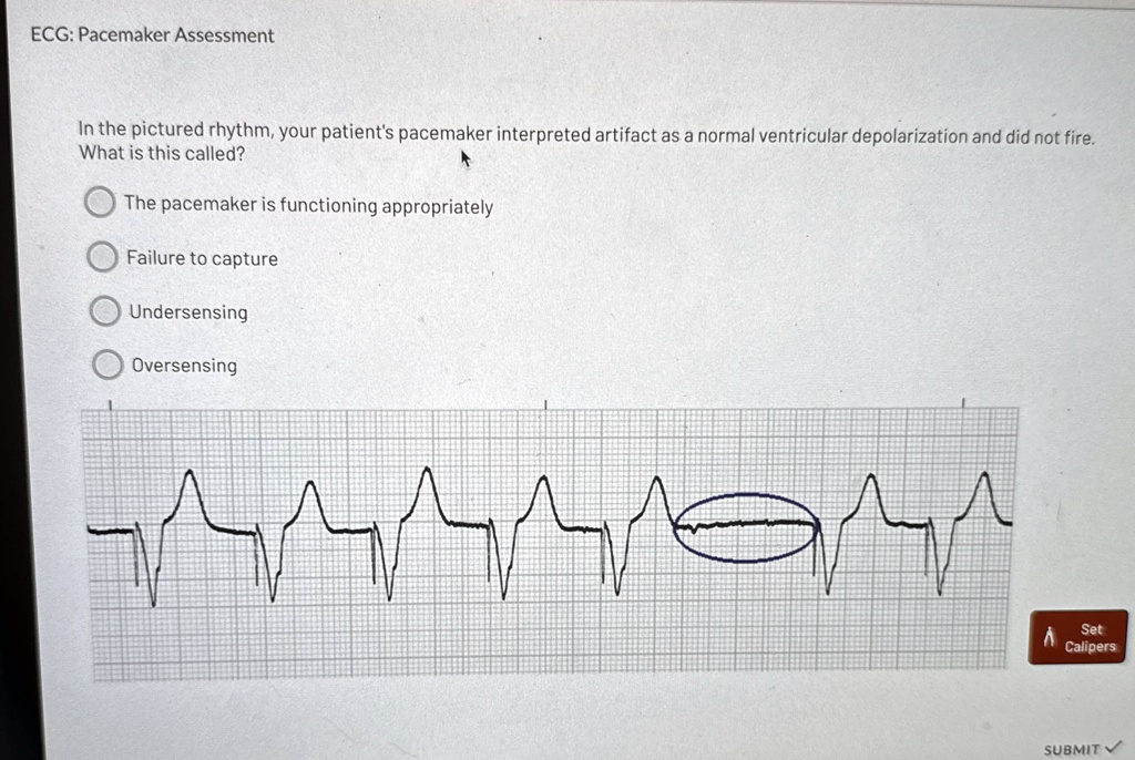 Ecg pacemaker assessment in the pictured rhythm your...