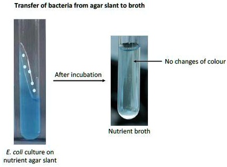 SOLVED: Transfer of bacteria from agar slant to broth No changes of ...
