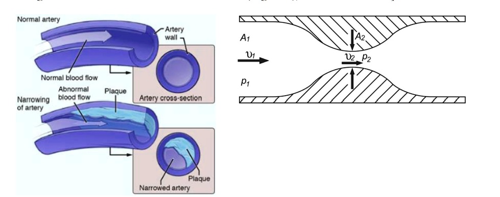 SOLVED: Using Bernoulli's equation, explain what happens to the ...