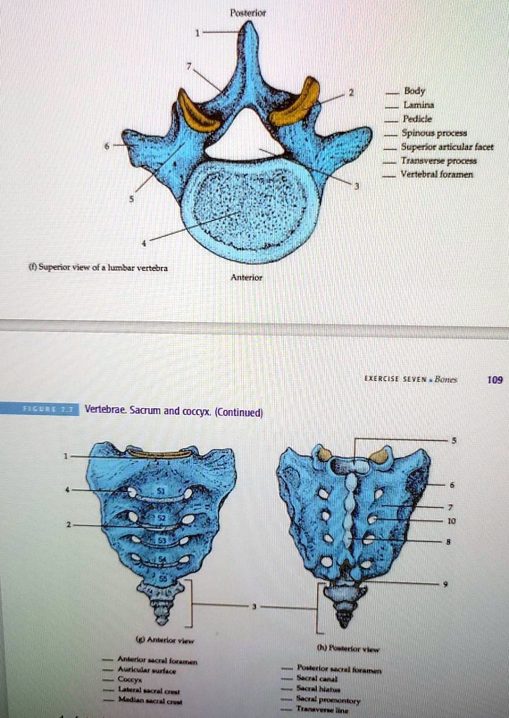 Posterior Body Lamina Pedicle Spinous process Superior articular facet Transverse process ...