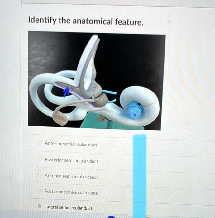 SOLVED: Identify the anatomical feature. Anterior semicircular duct ...