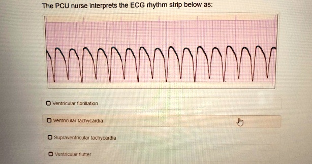 The PCU nurse interprets the ECG rhythm strip below as: Ventricular ...