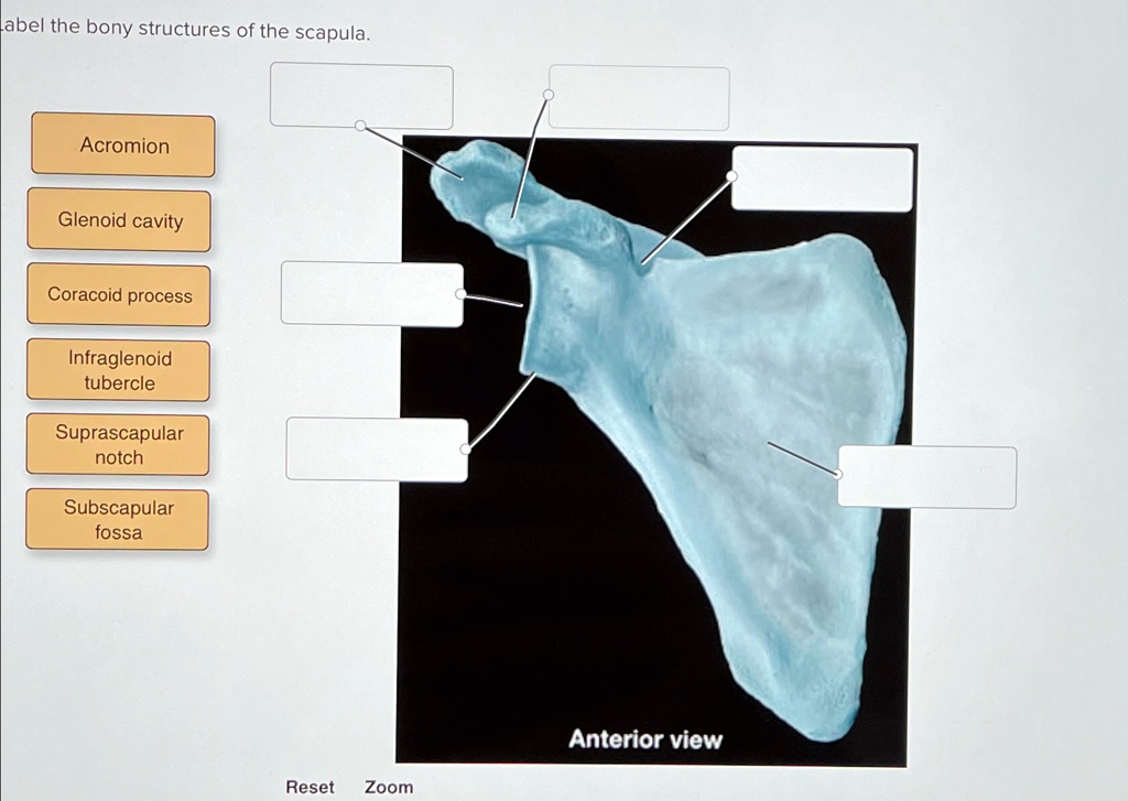 Label the bony structures of the scapula. Acromion Glenoid cavity Coracoid process Infraglenoid ...