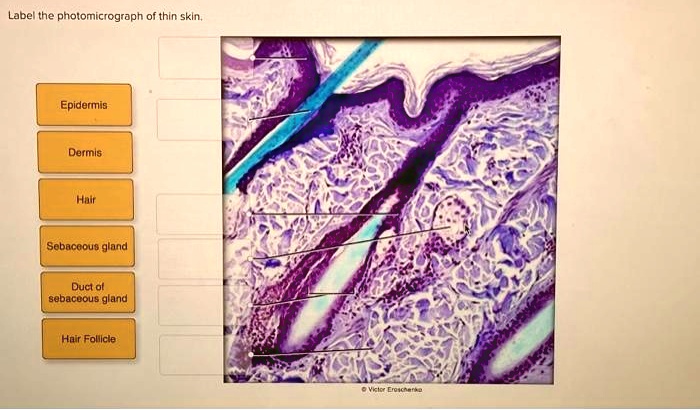 SOLVED: Label the photomicrograph of thin skin. Epidermis Dermis Hair ...