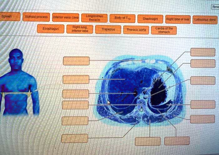 Spleen Xiphoid process Inferior vena cava Longissimus thoracis Body of ...