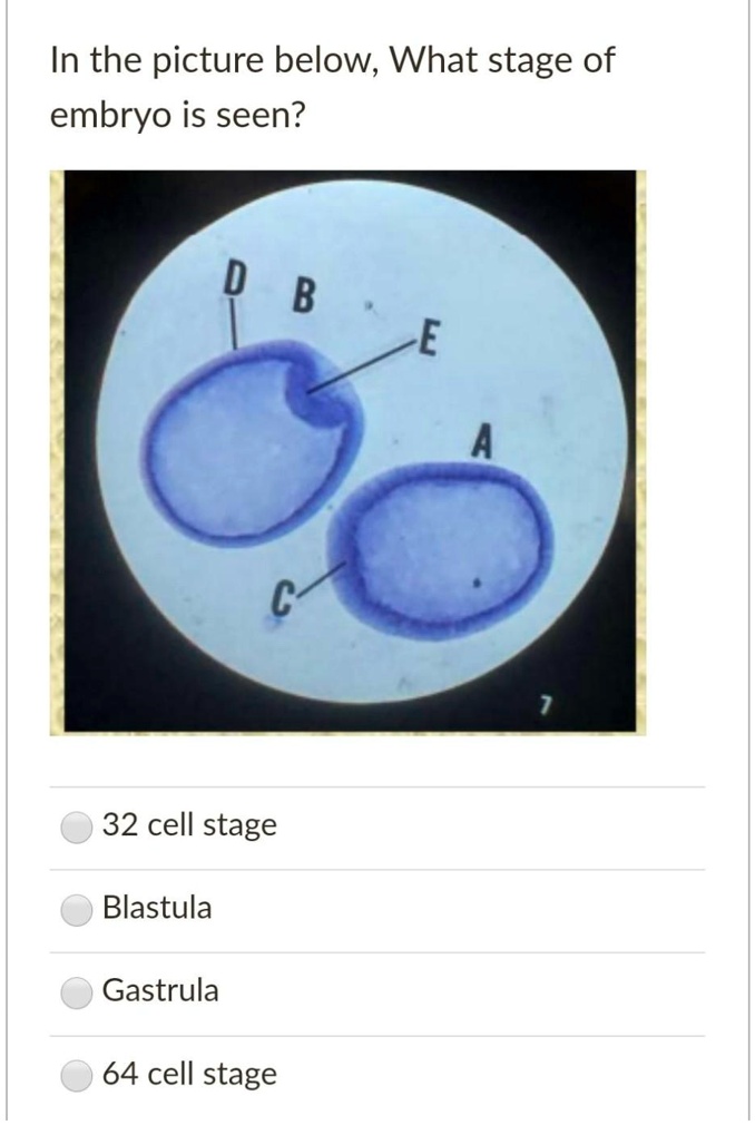 SOLVED: In the picture below, What stage of embryo is seen? 0 B A ` 32 ...