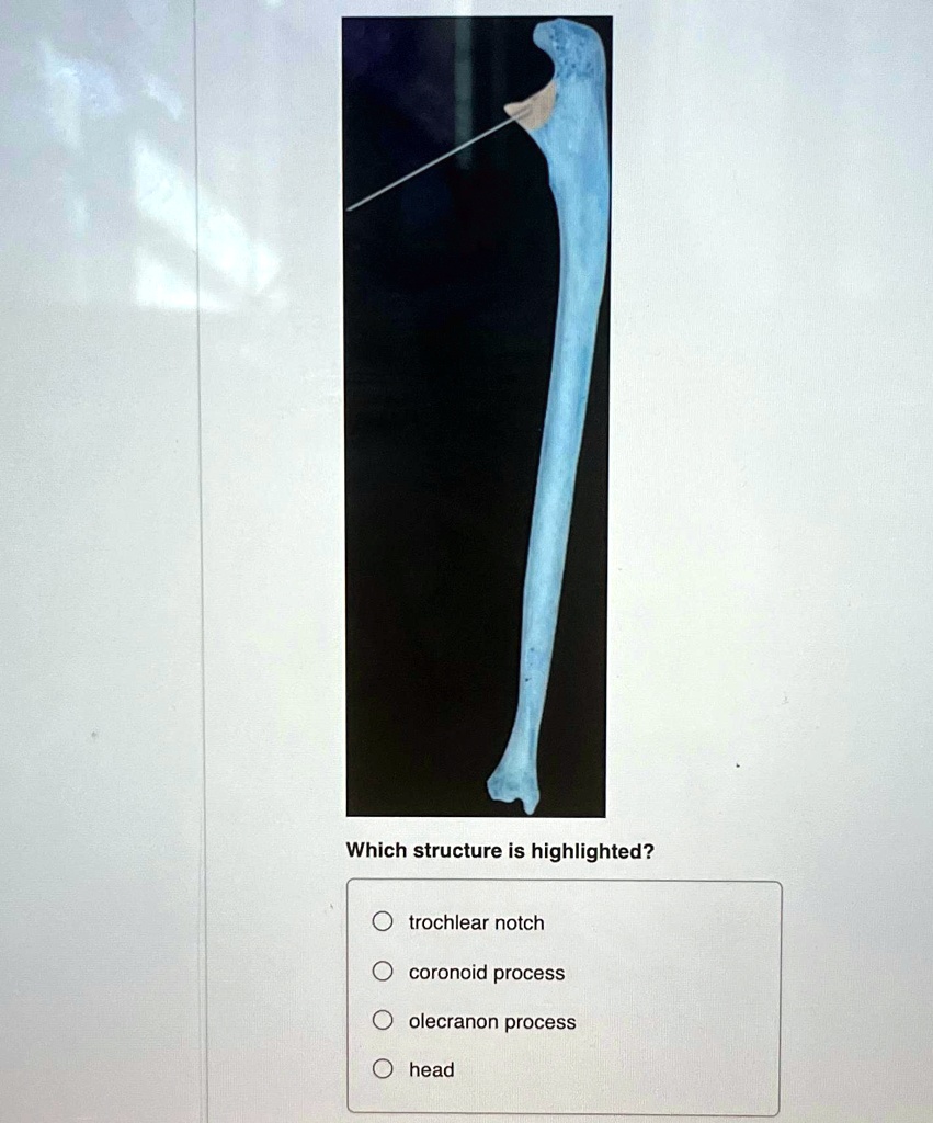 Which structure is highlighted? - trochlear notch - coronoid process ...