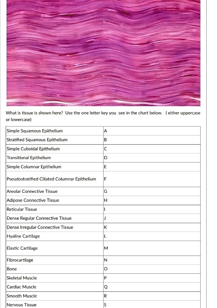 SOLVED: What is tissue is shown here? Use the one letter key you see in ...