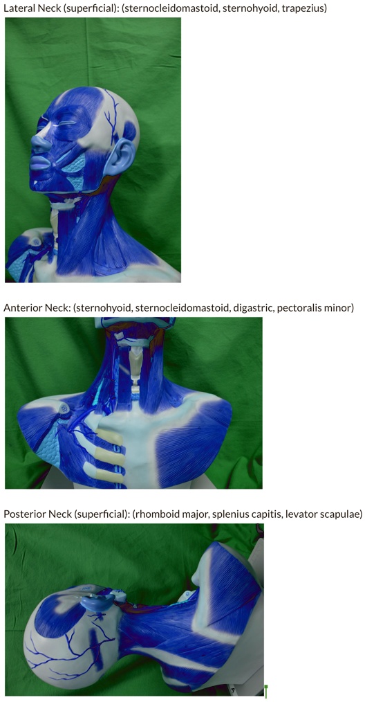 SOLVED: Identify the landmarks/features indicated by each image in ...