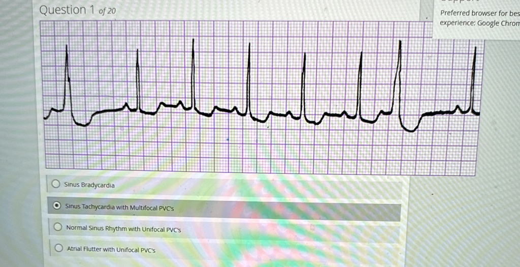 question 1 of 20 sinus bradycardia sinus tachycardia with multifocal ...