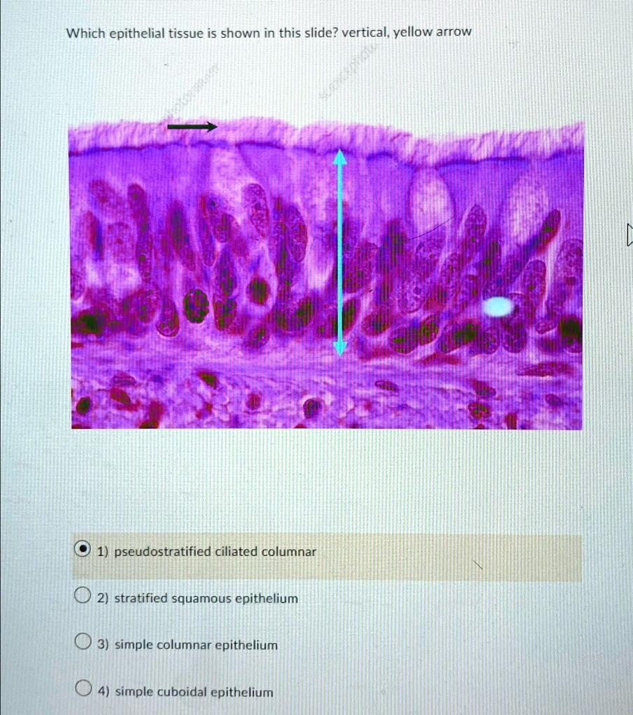 SOLVED: Which epithelial tissue is shown in this slide? vertical ...