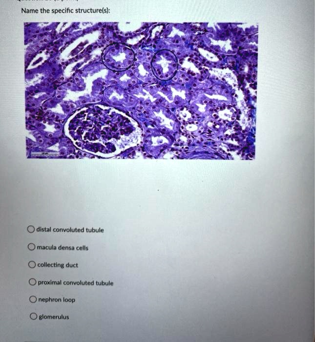 SOLVED: Name the specific structure(s: distal convoluted tubule macula ...