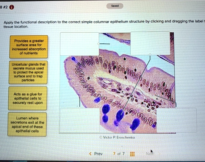 5uted 8 2 0 apply the functiona description t0 the correct simple columnar epithelium structure ...