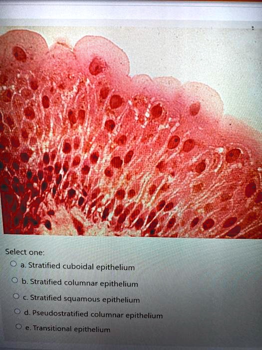 SOLVED: Select one: Stratified cuboidal epithelium b. Stratified ...