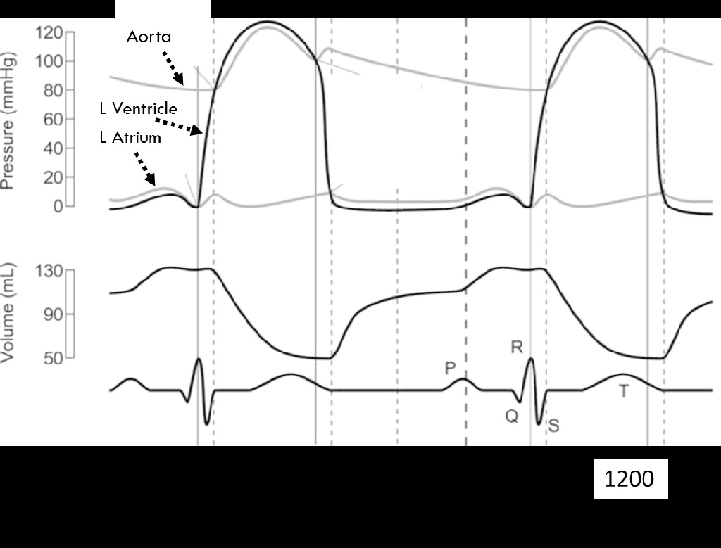 SOLVED: Below is a Wiggers diagram. Calculate the following: 1. Heart rate 2. Stroke volume 3 ...