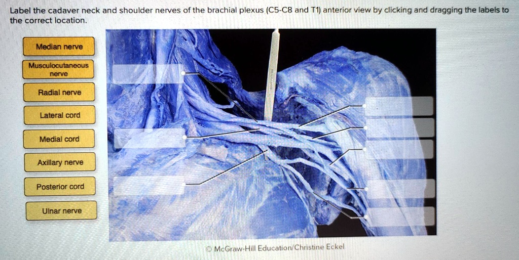 Label the cadaver neck and shoulder nerves of the brachial plexus (C5 ...