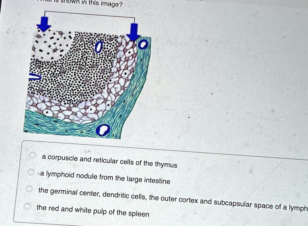 shown in this image? a corpuscle and reticular cells of the thymus a ...