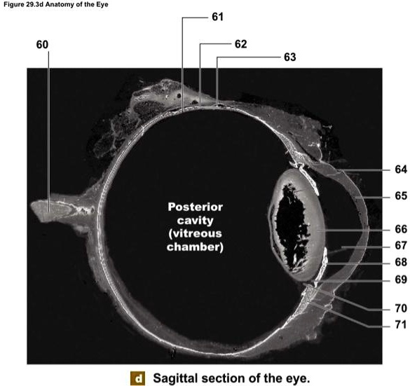 Figure 29.3d Anatomy of the Eye 61 60 62 63 64 65 Posterior cavity ...