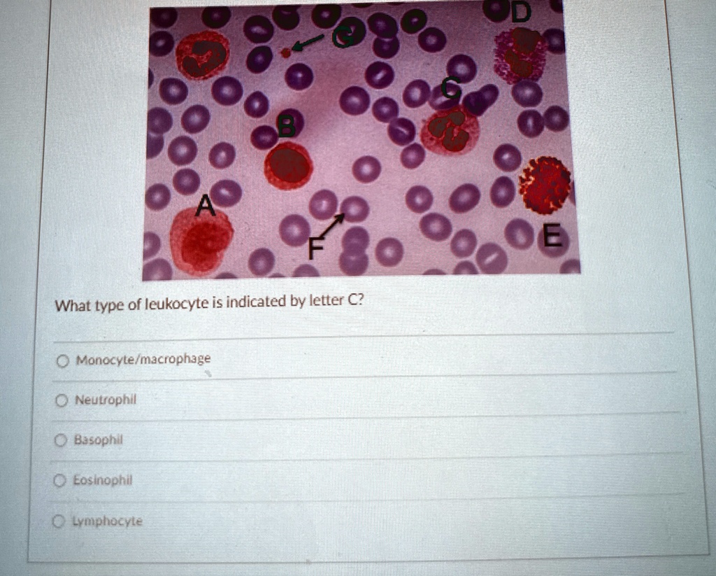 What type of leukocyte is indicated by letter C? Monocyte/macrophage ...