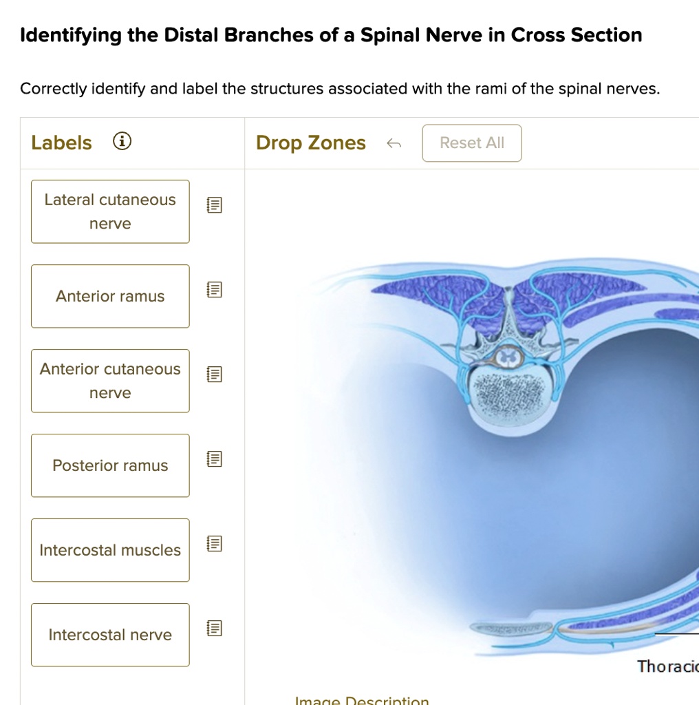 Identifying the Distal Branches of a Spinal Nerve in Cross Section ...