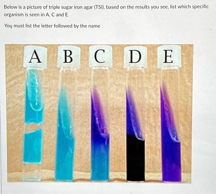 VIDEO solution: Below is a picture of triple sugar iron agar (TSI ...