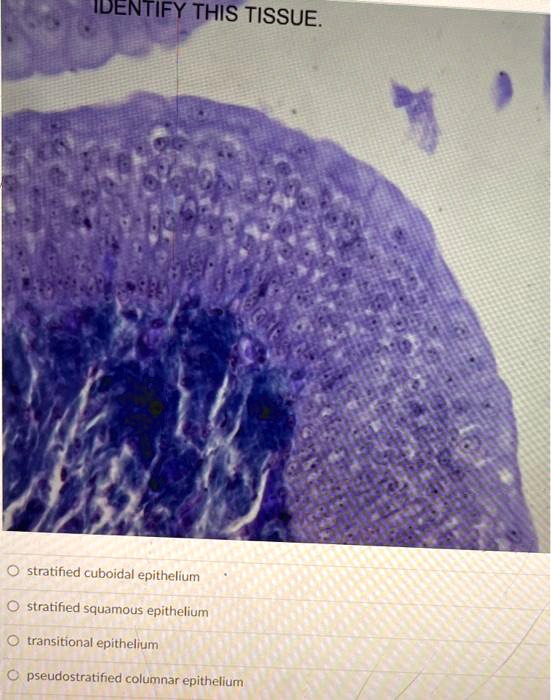SOLVED: Identify This Tissue - Stratified cuboidal epithelium ...