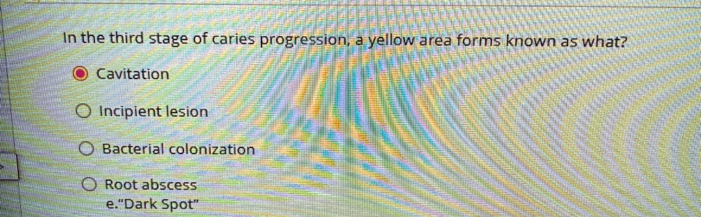 in the third stage of caries progression a yellow area forms known as ...