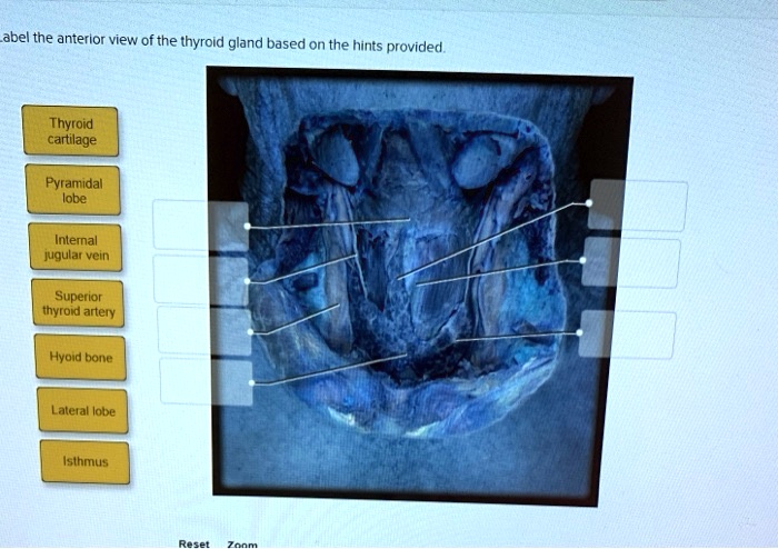 abel the anterior view of the thyroid gland based on the hints provided ...