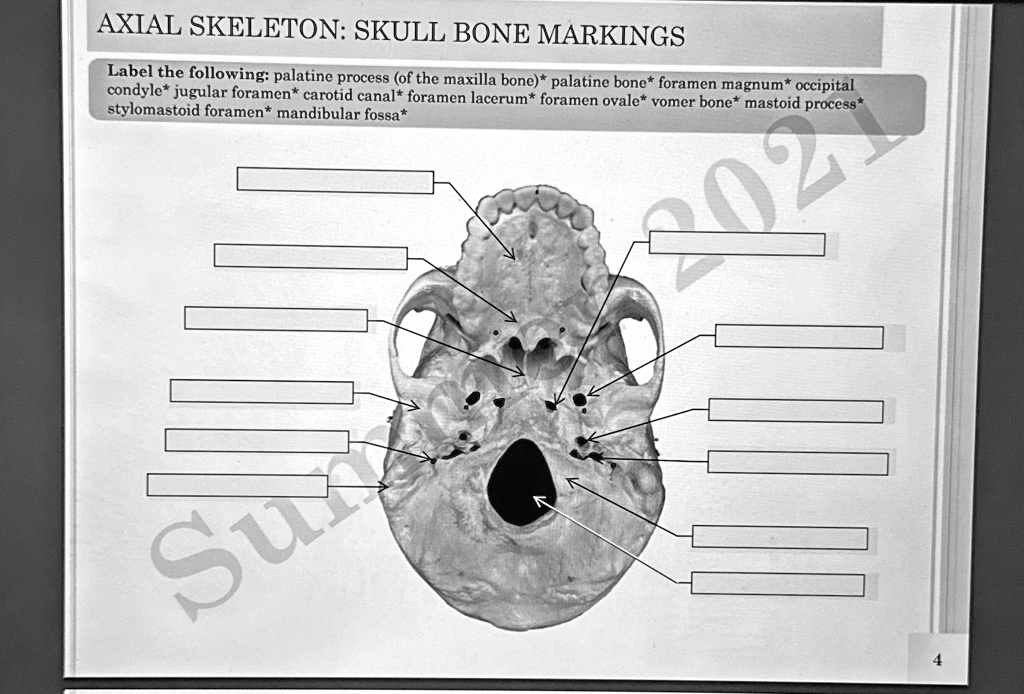AXIAL SKELETON: SKULL BONE MARKINGS Label the following: palatine process (of the maxilla bone ...