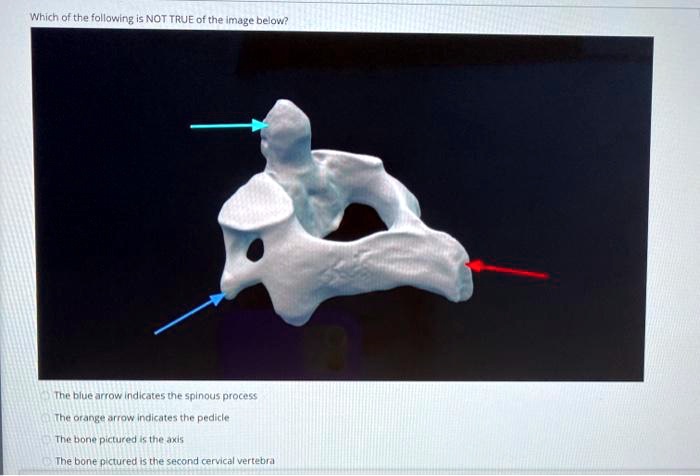 which of the following is not true of the image below the blue arrow ...