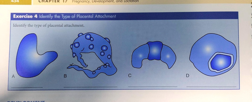 SOLVED: Exercise 4: Identify the Type of Placental Attachment Identify ...
