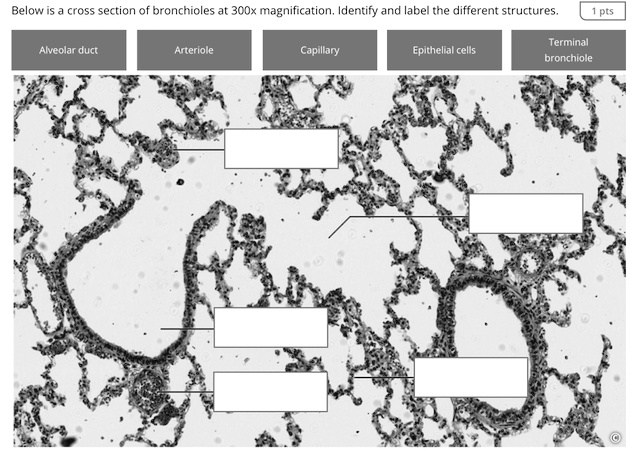 SOLVED: Below is a cross section of bronchioles at 300x magnification ...