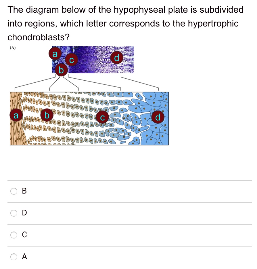 [GET ANSWER] The diagram below of the hypophyseal plate is subdivided ...
